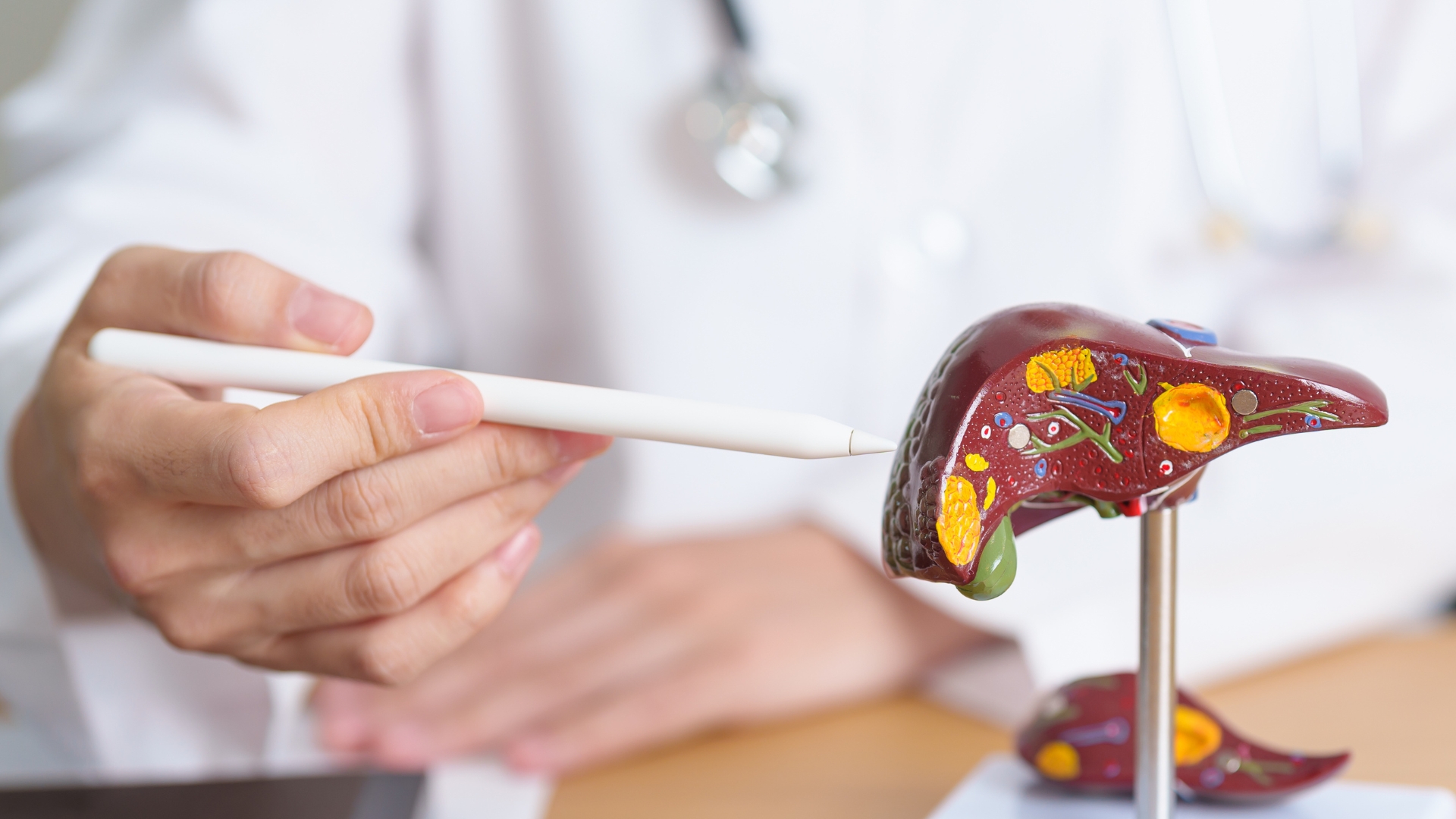 ¿Cuándo se indica realizar un perfil hepático? - Clinica Andes Salud ...